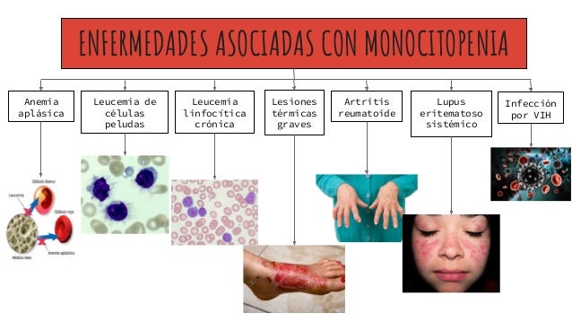 Linfocitosis, monocitosis y eosinofilia