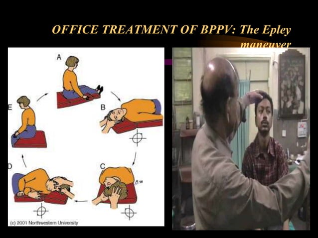 Clinic based management of vertigo. | PPT