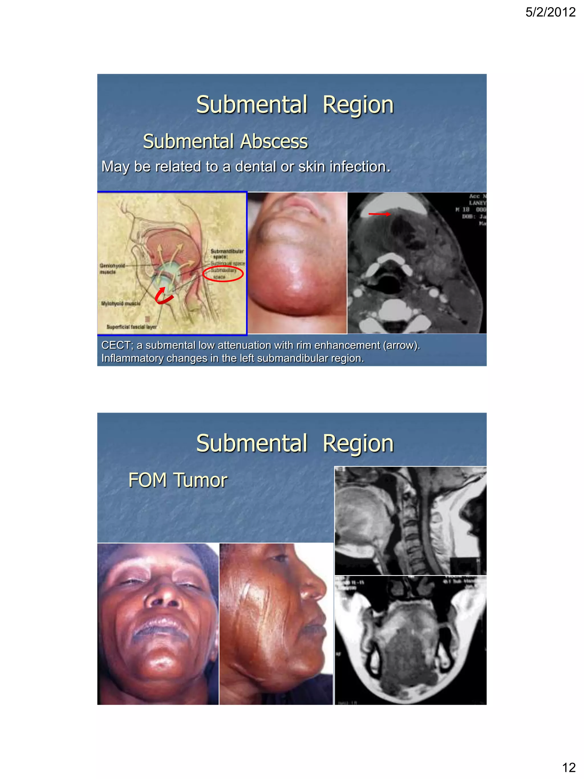 Clinico Radiological Approach For Diagnosis Of Neck Swellings Pdf