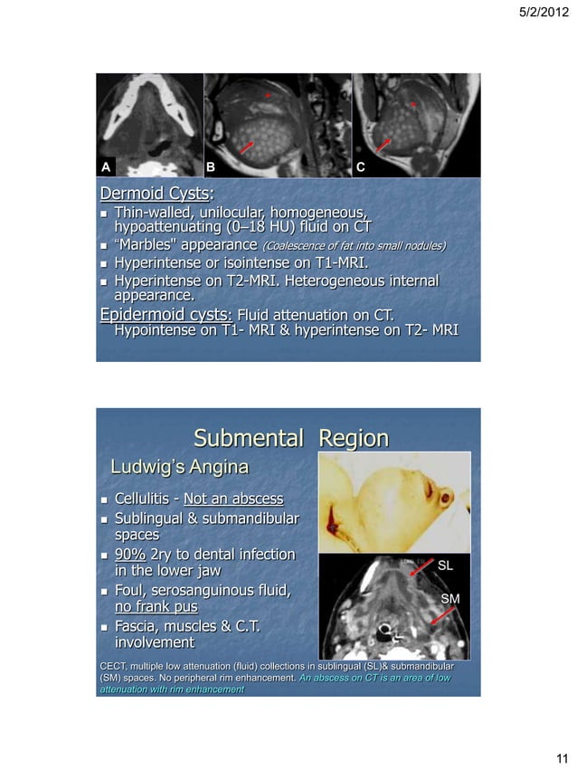 Clinico Radiological Approach For Diagnosis Of Neck Swellings Pdf