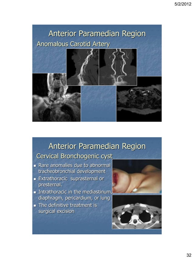 Clinico Radiological Approach For Diagnosis Of Neck Swellings Pdf