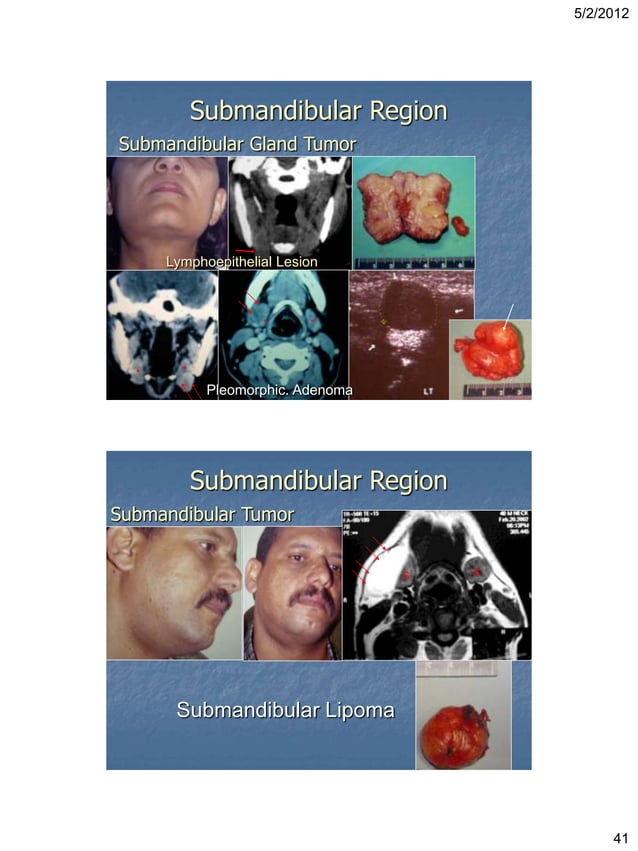 Clinico Radiological Approach For Diagnosis Of Neck Swellings Pdf