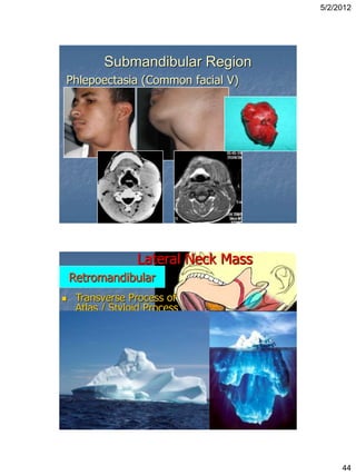 Clinico radiological approach for diagnosis of neck swellings | PDF