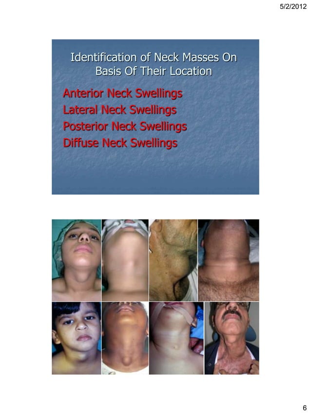 Clinico Radiological Approach For Diagnosis Of Neck Swellings Pdf