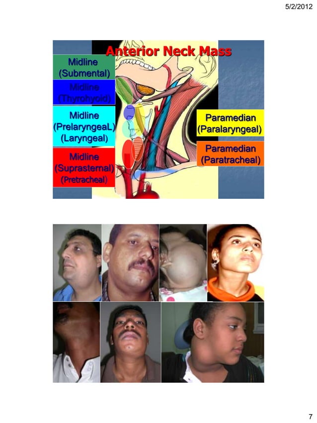 Clinico Radiological Approach For Diagnosis Of Neck Swellings Pdf