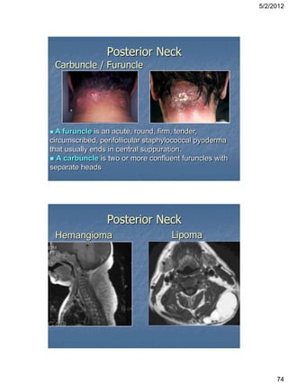 Clinico radiological approach for diagnosis of neck swellings | PDF