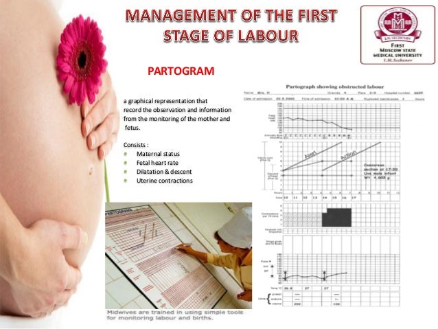 Clinic of the labor obstetric