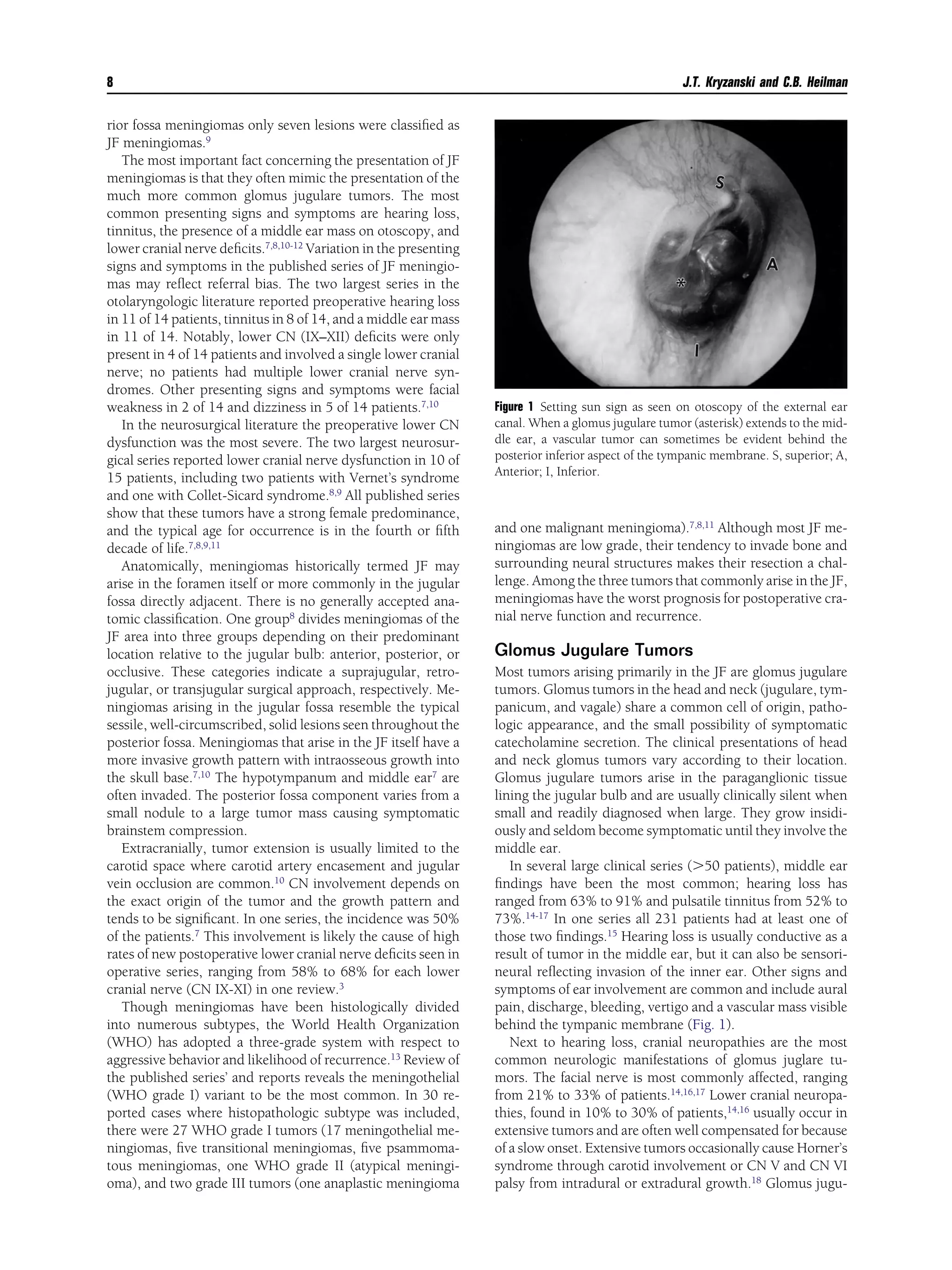 Clinicopathologic features of jugular foramen tumors | PDF