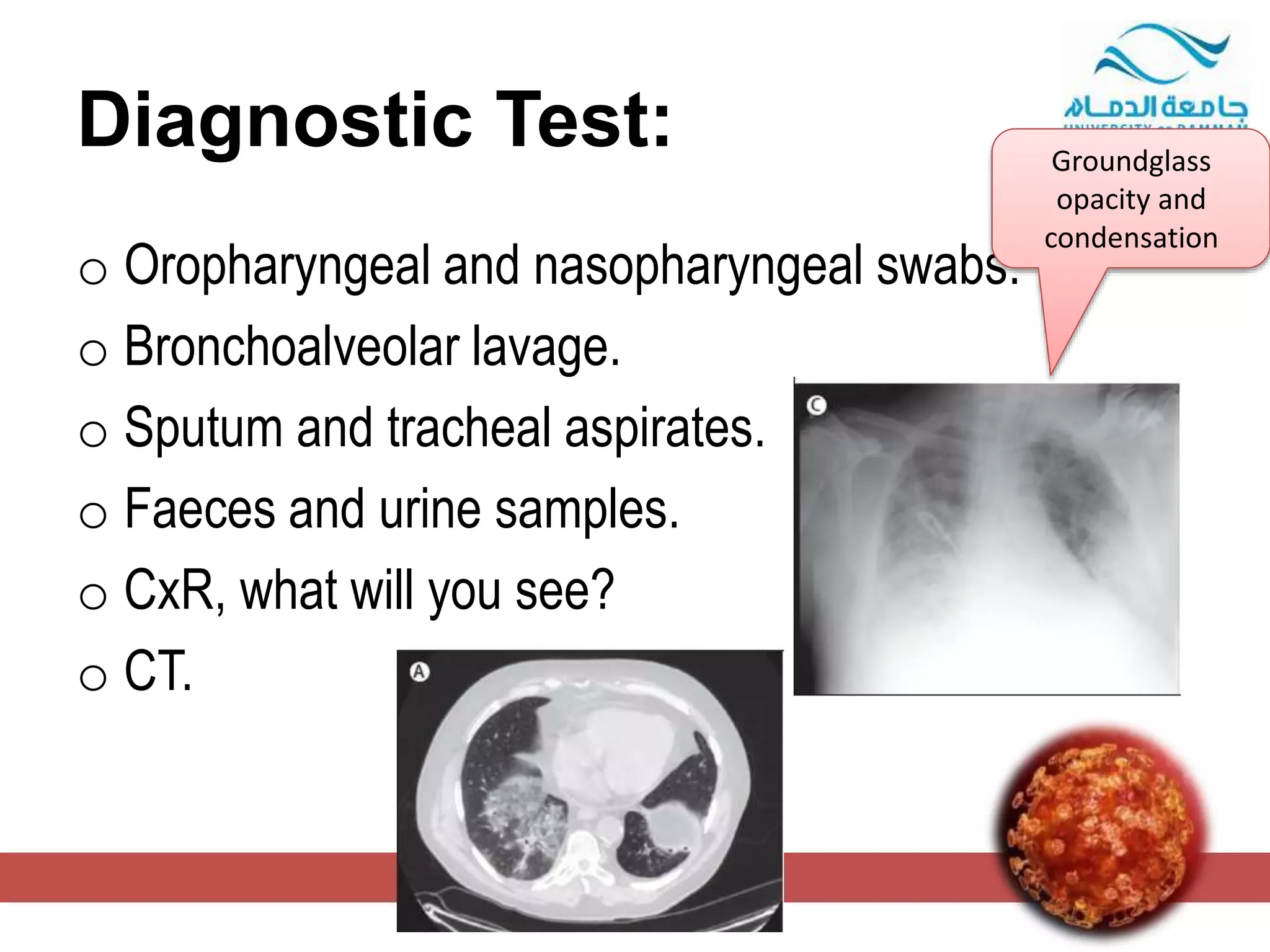 Middle East Respiratory Syndrome "MERS-CoV" | PPTX
