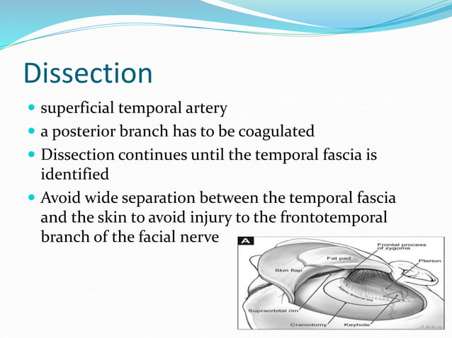 Clinoidal meningioma | PPTX | Ear, Nose and Throat Conditions ...