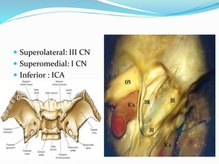 Clinoidal meningioma | PPTX