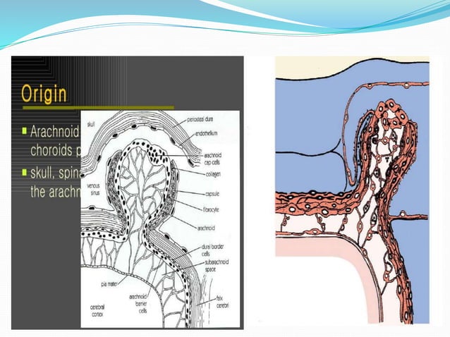 Clinoidal meningioma | PPTX | Ear, Nose and Throat Conditions ...