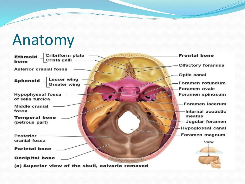 Clinoidal meningioma