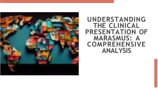 Clin Pres of Marasmus.pptx
