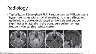 Chronic Lymphocytic Inflammation with Pontine Perivascular Enhancement ...