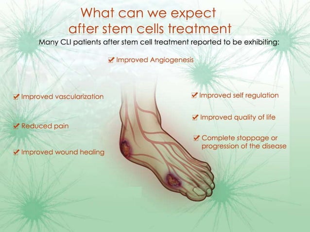 Critical Limb Ischemia (CLI) | PPTX