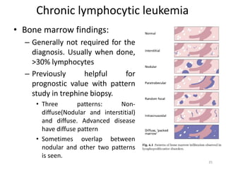 Chronic lymphocytic leukemia | PPTX