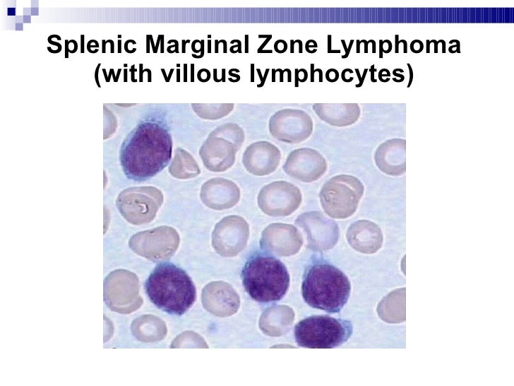 CLL - TSH Midyear 2009