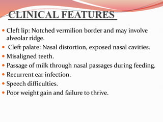 cleft lip and palate | PPTX | Ear, Nose and Throat Conditions ...