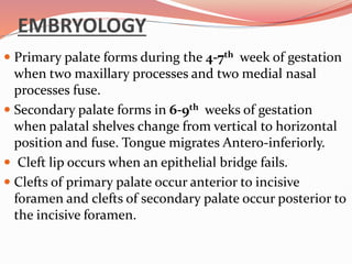 cleft lip and palate | PPTX