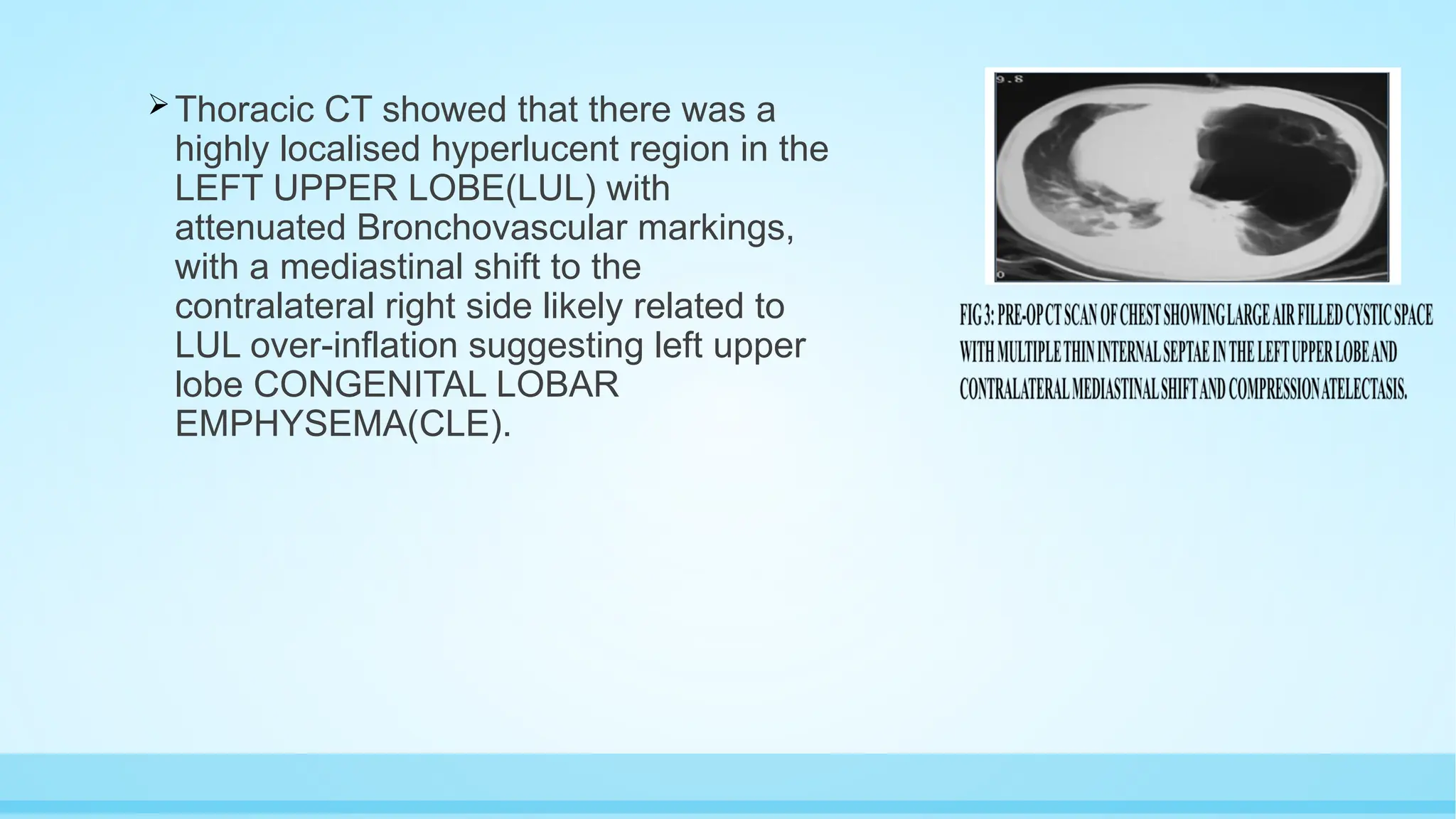 CLM POSTER (2)animation emphysema 1.pptx