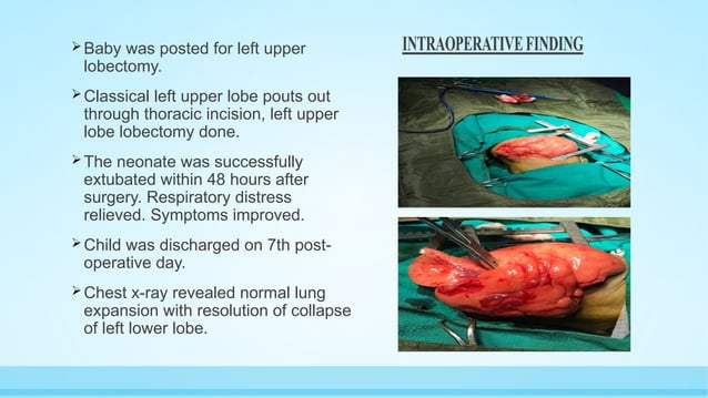 CLM POSTER (2)animation emphysema 1.pptx