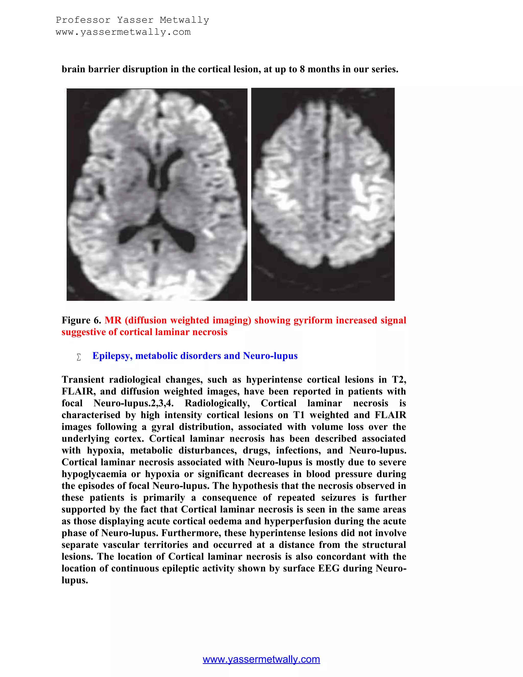 Radiological pathology of cortical laminar necrosis | PDF