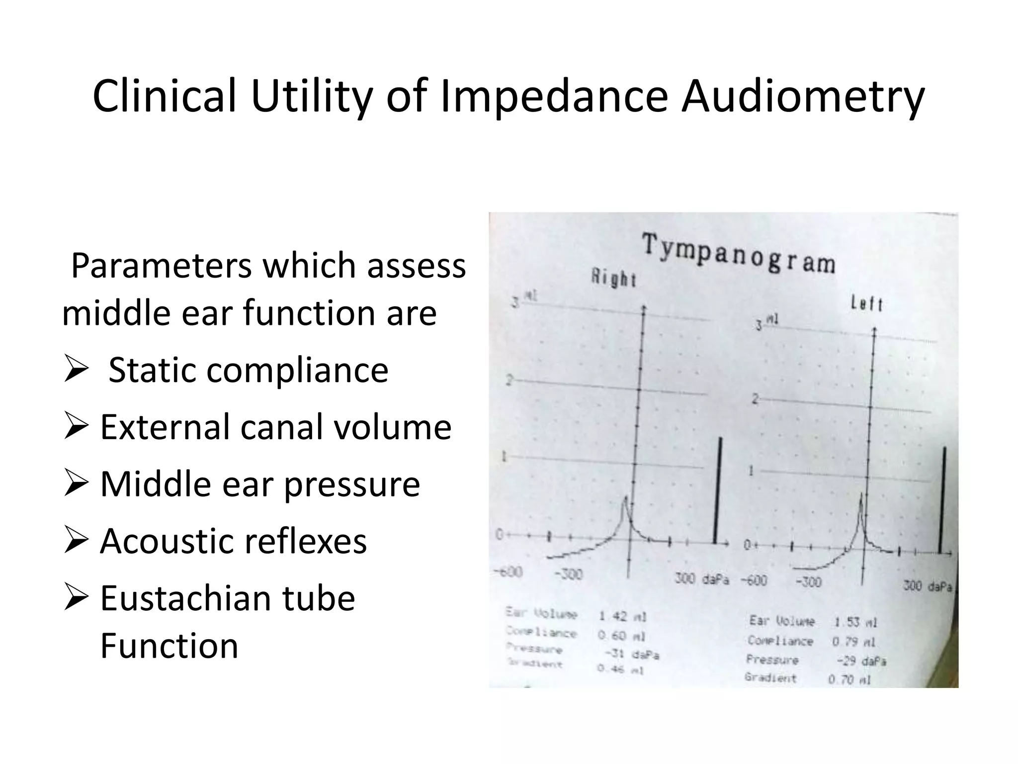 Clncal utility of impedance audiometry | PPTX | Ear, Nose and Throat ...