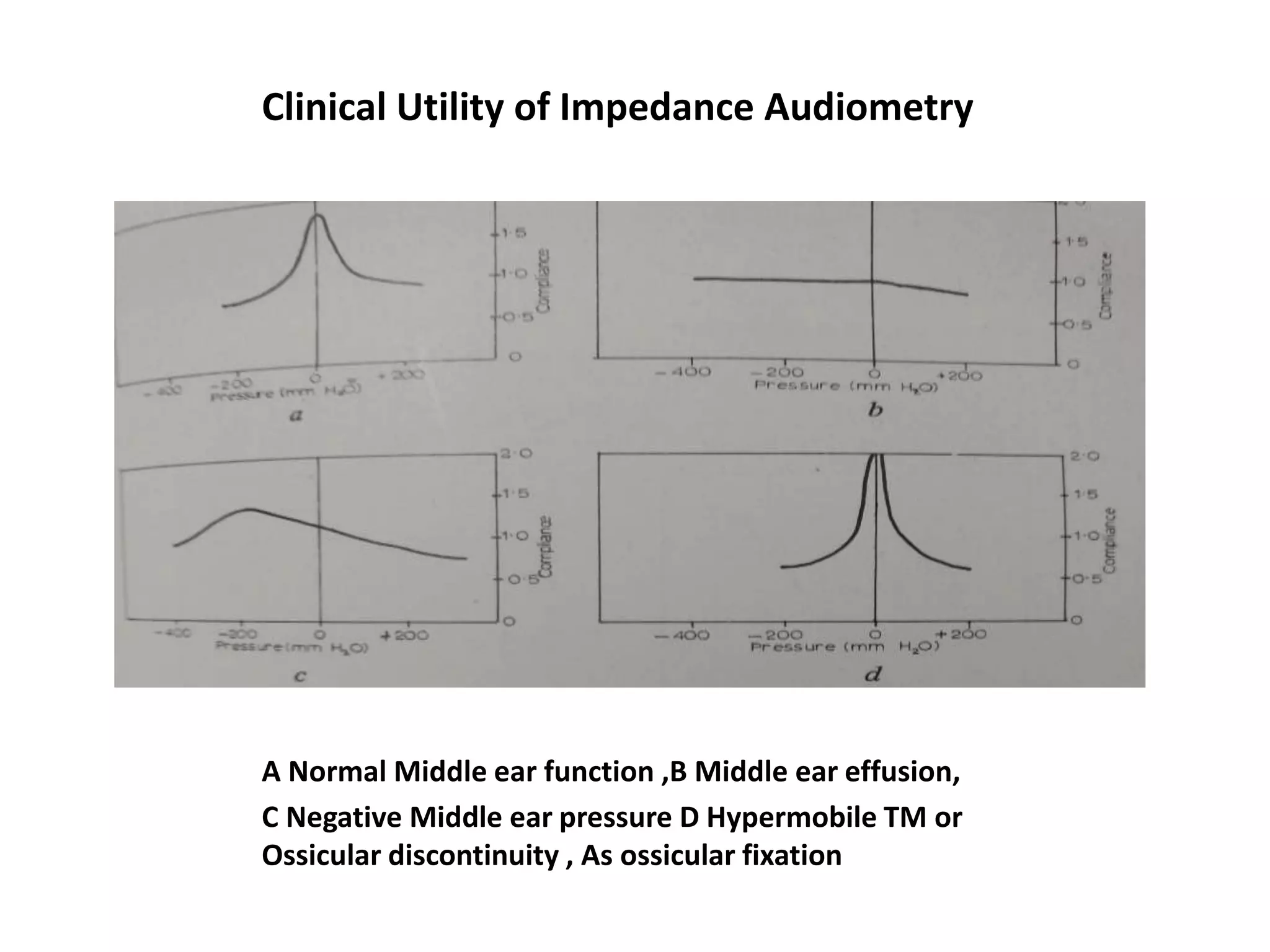 Clncal utility of impedance audiometry | PPTX | Ear, Nose and Throat Conditions | Diseases and ...