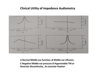 Clncal utility of impedance audiometry | PPTX