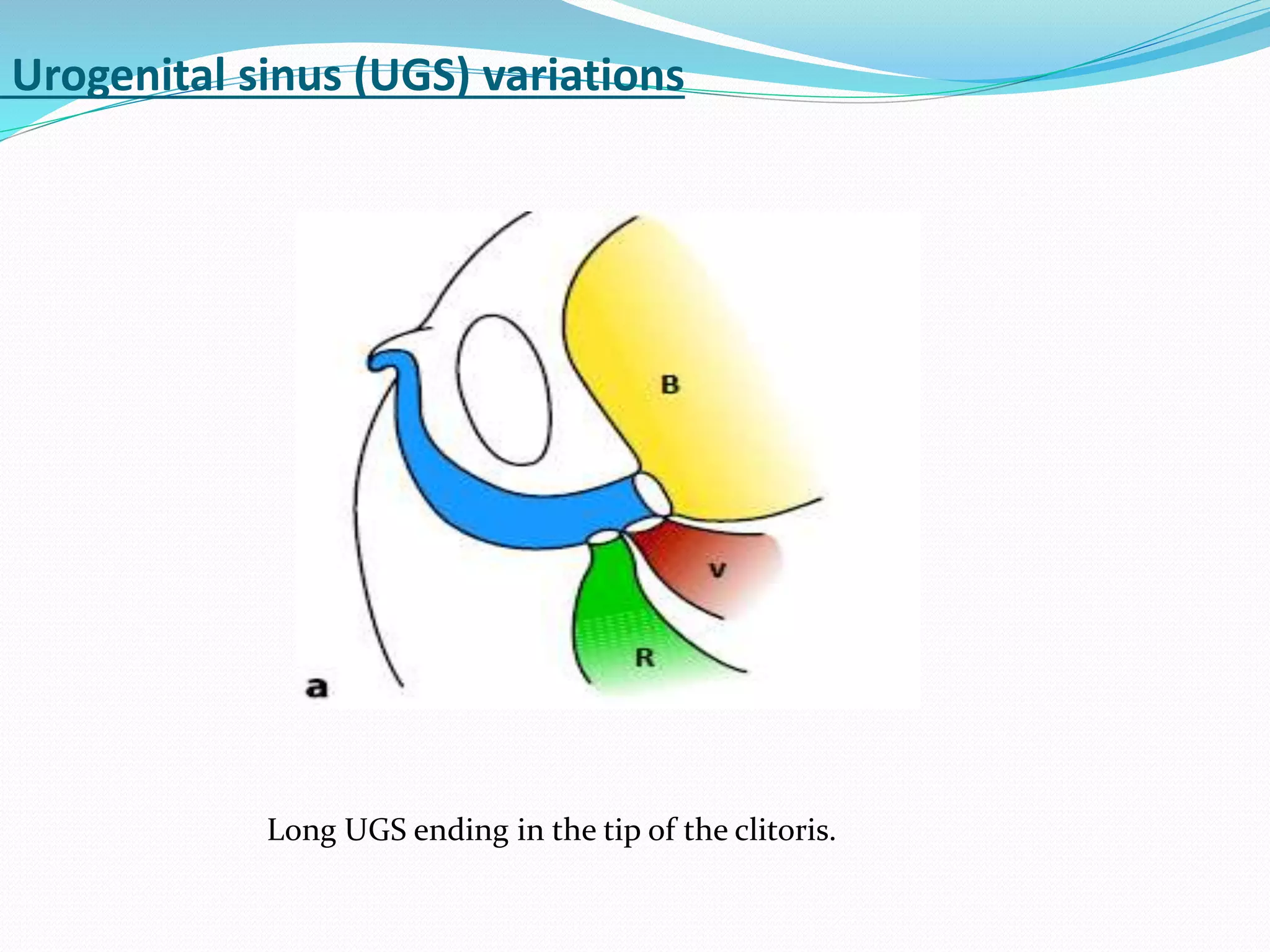Cloaca approach to decision making | PPTX