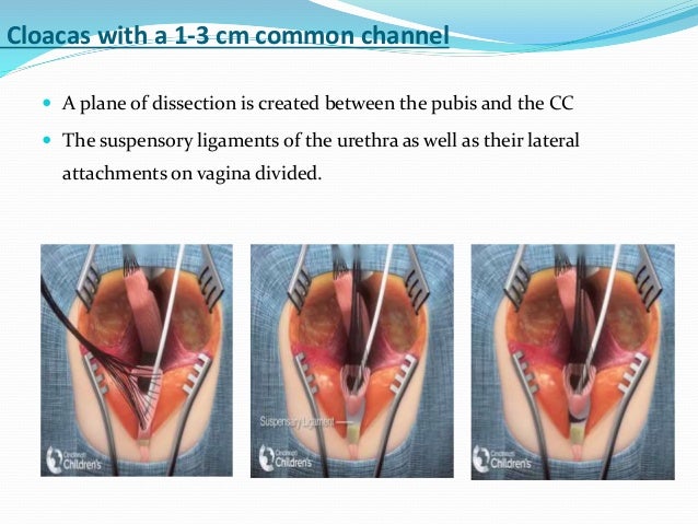Cloaca approach to decision making