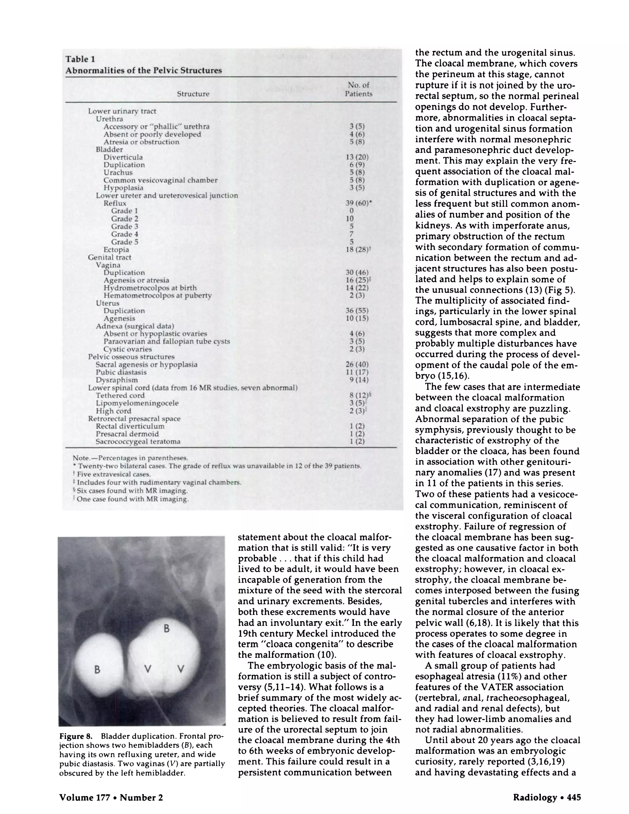 Cloacal malformation.full
