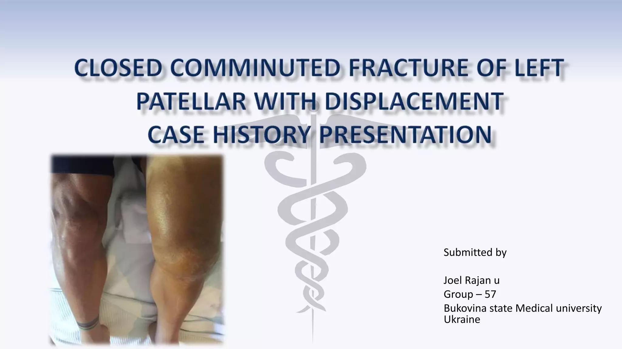 comminuted fracture of left patellar with displacement case ...