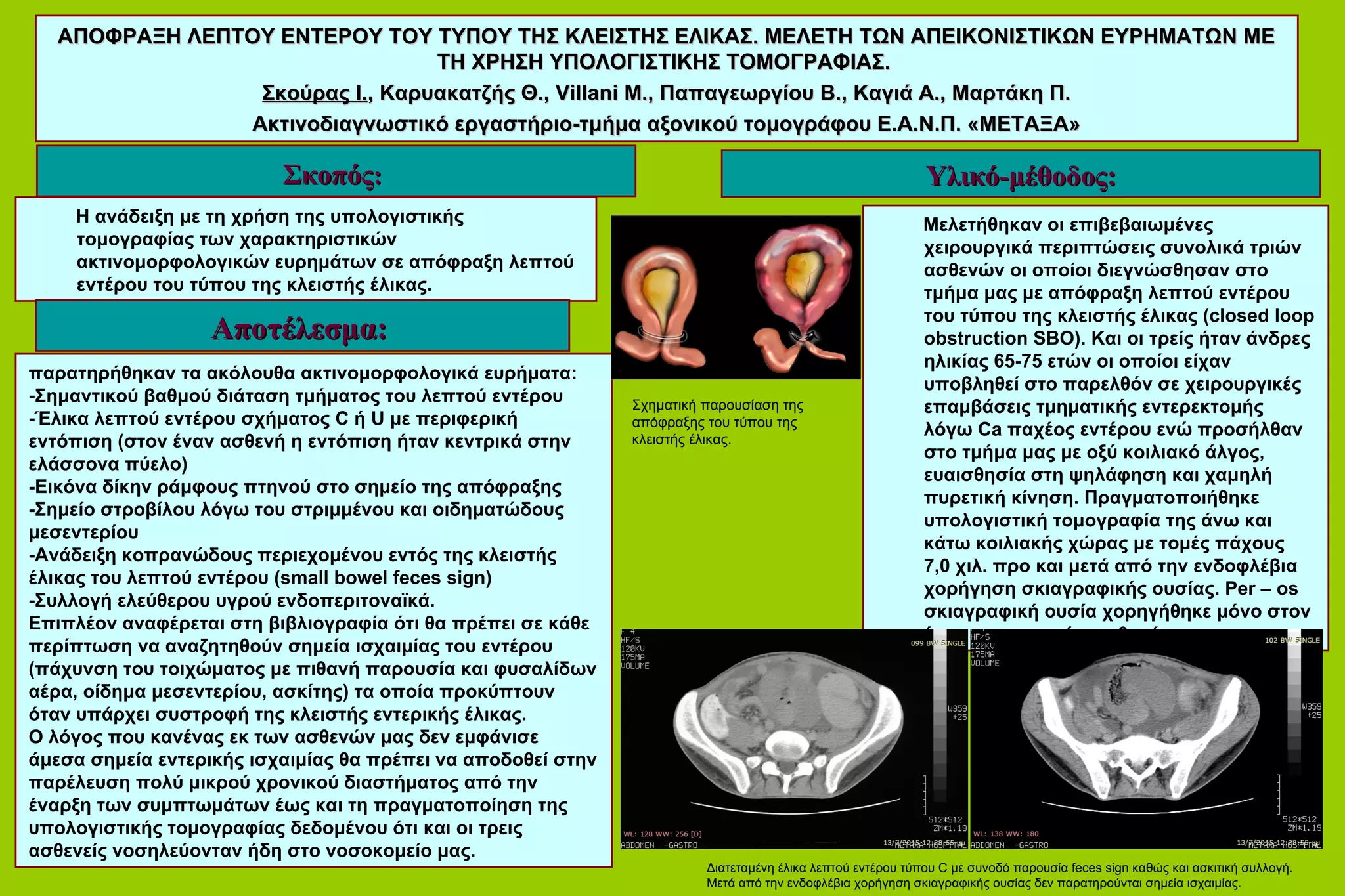 Closed loop obstruction | PPT