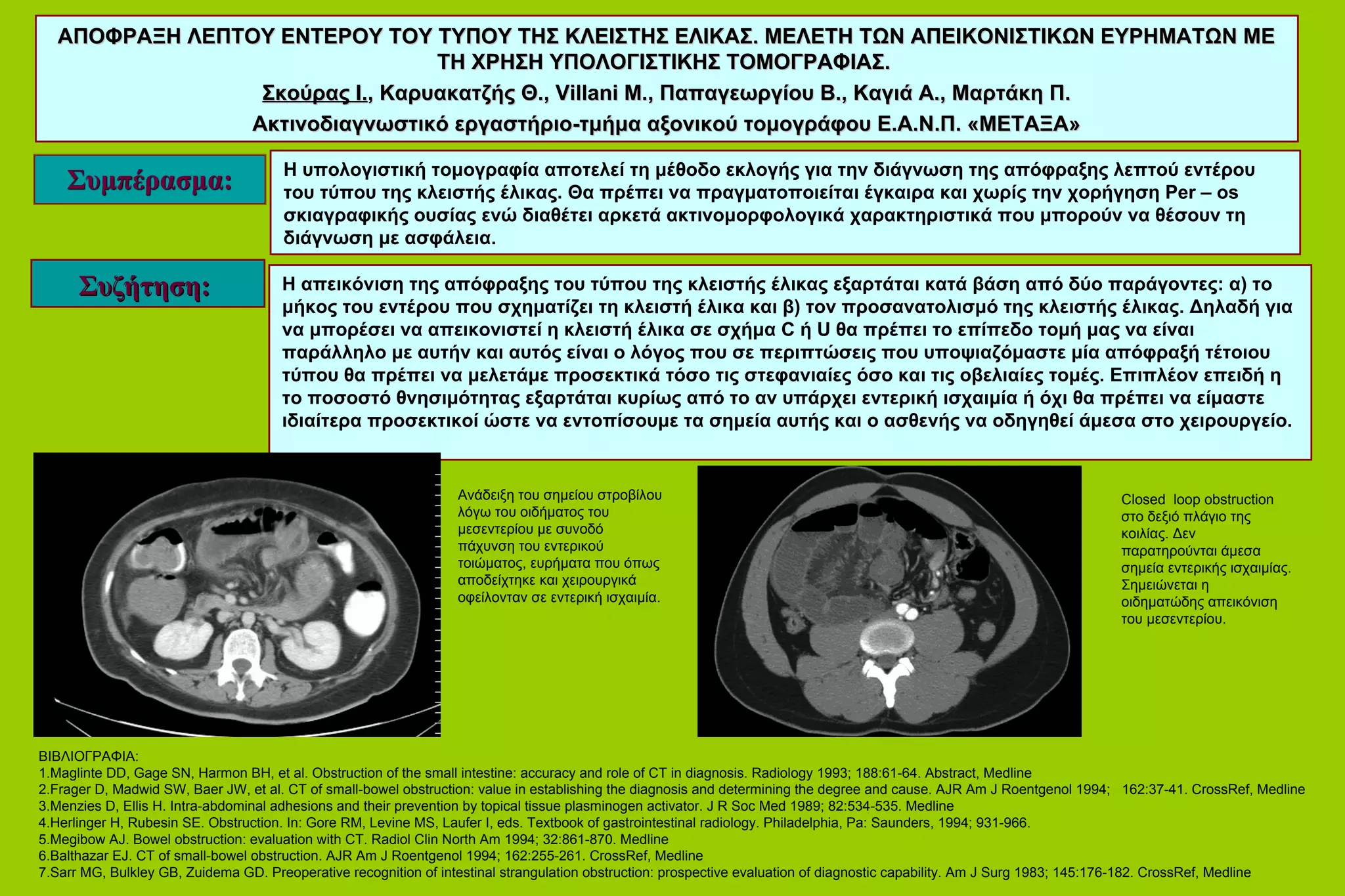 Closed loop obstruction | PPT