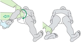closed reduction techniques in neck of femur fracture.pptx