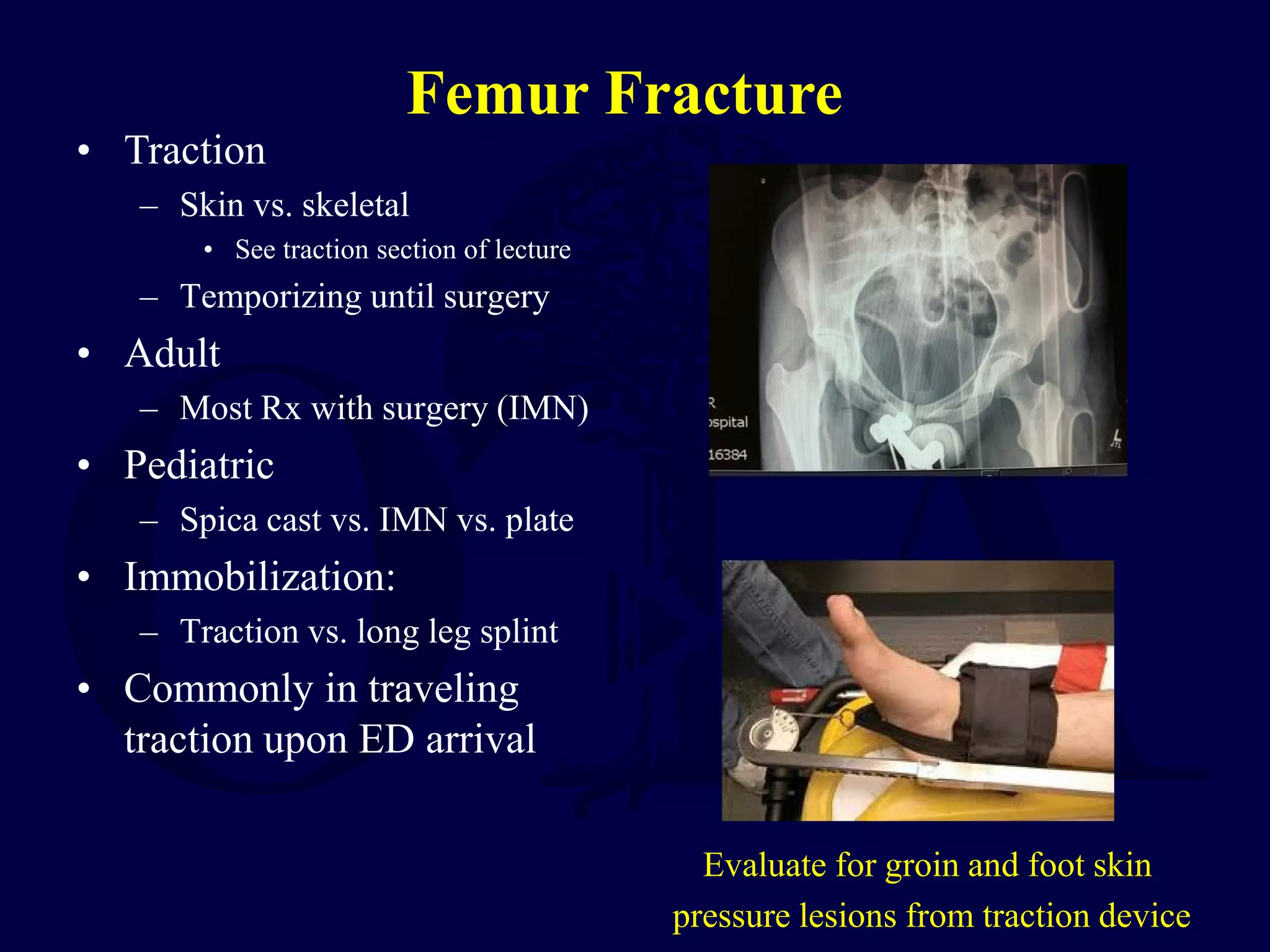Closed_Reduction,_Traction_and_Casting_Techniques.pdf