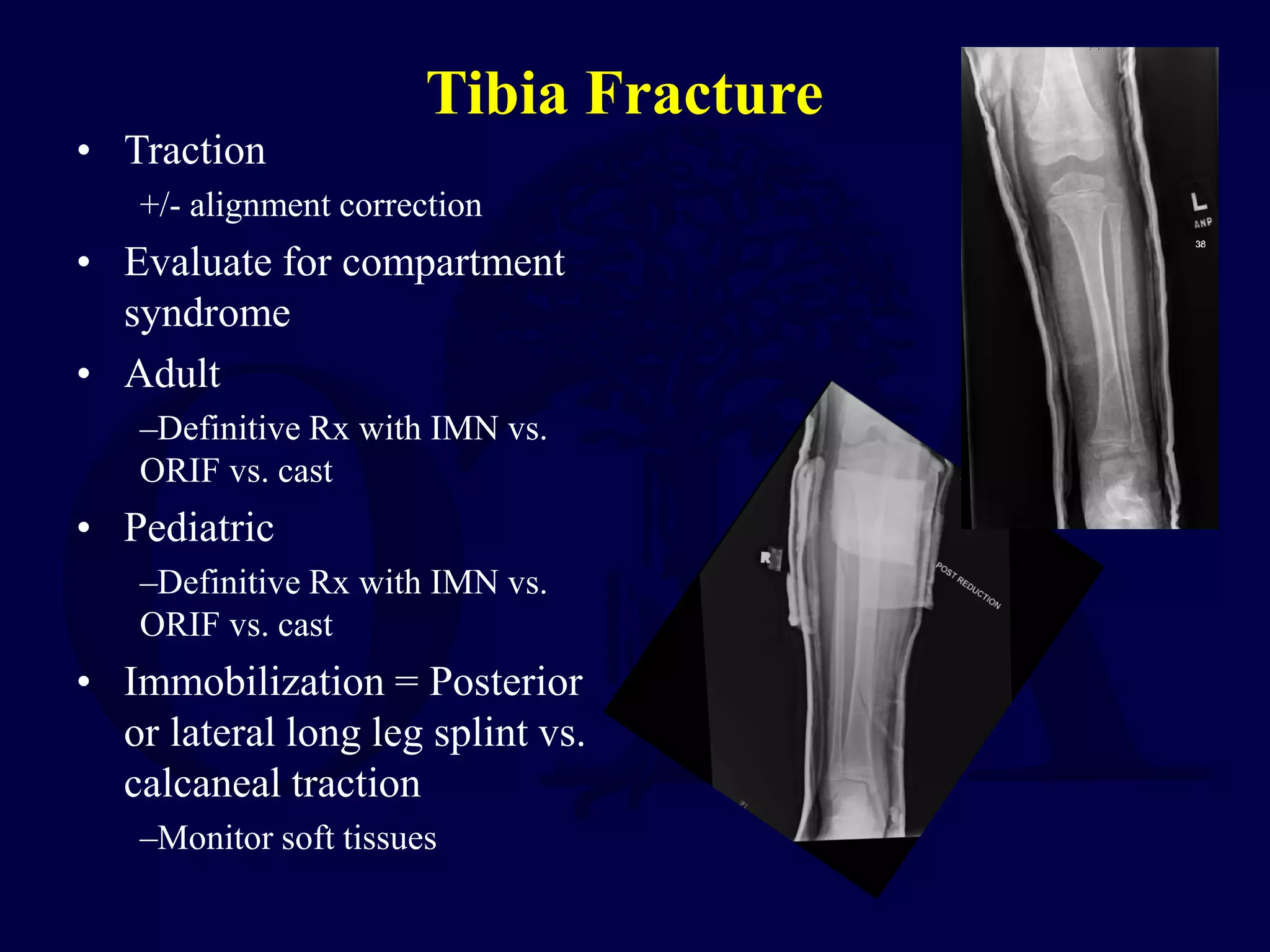 Closed_Reduction,_Traction_and_Casting_Techniques.pdf