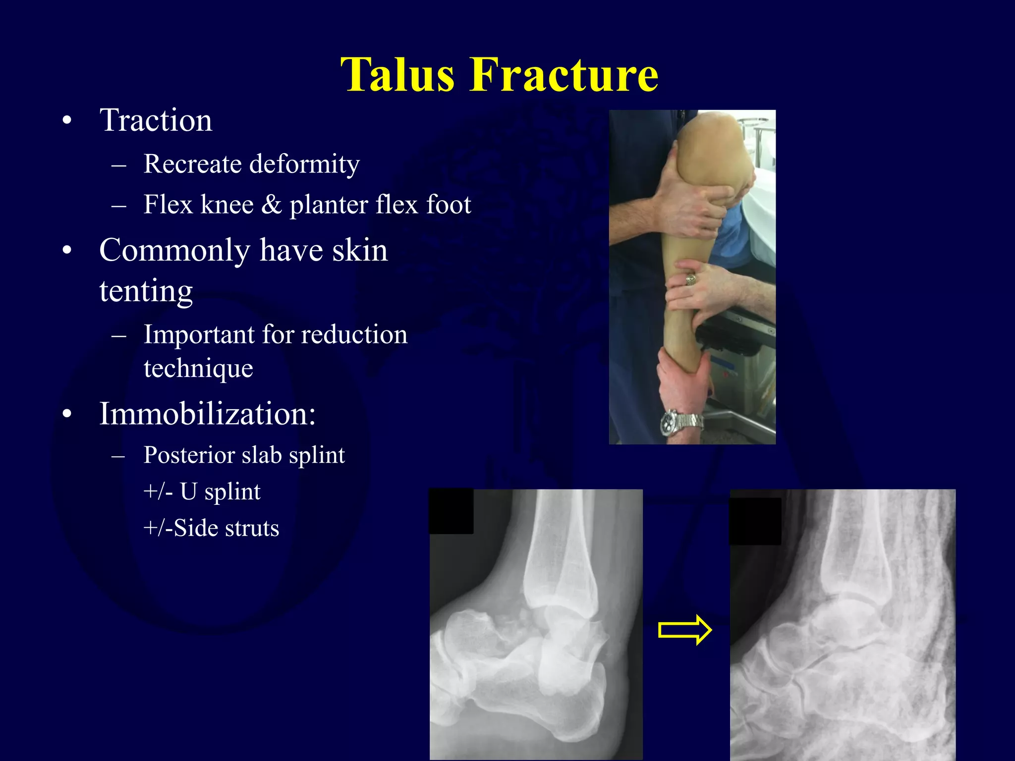 Closed_Reduction,_Traction_and_Casting_Techniques.pdf