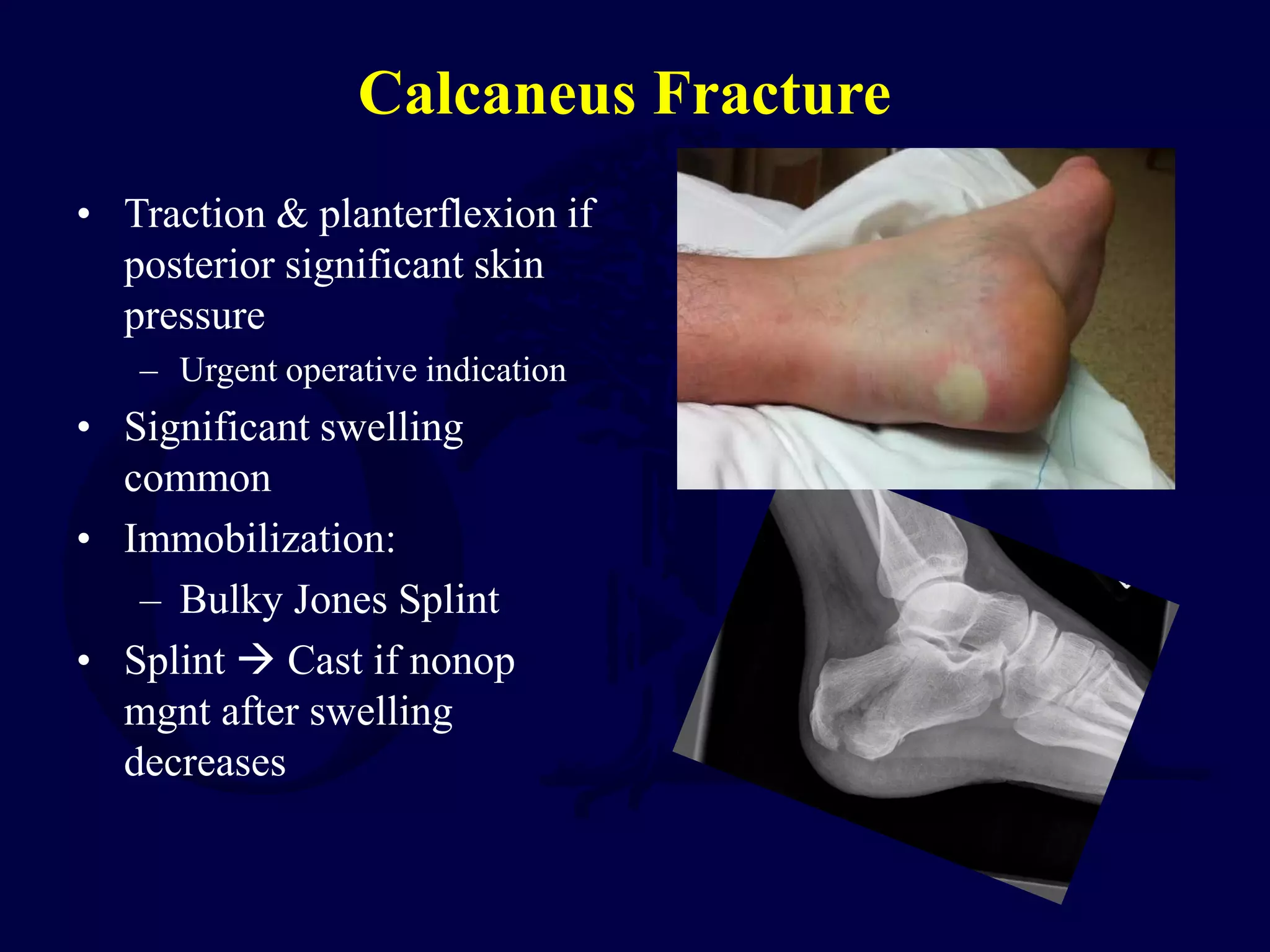 Closed_Reduction,_Traction_and_Casting_Techniques.pdf