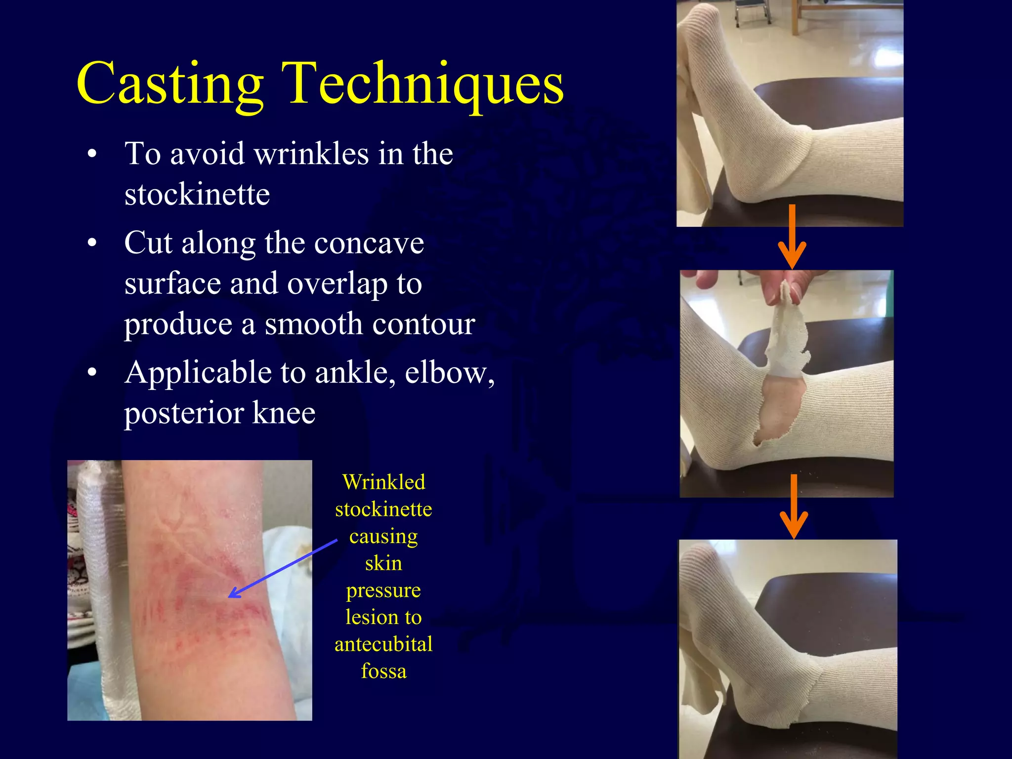 Closed_Reduction,_Traction_and_Casting_Techniques.pdf