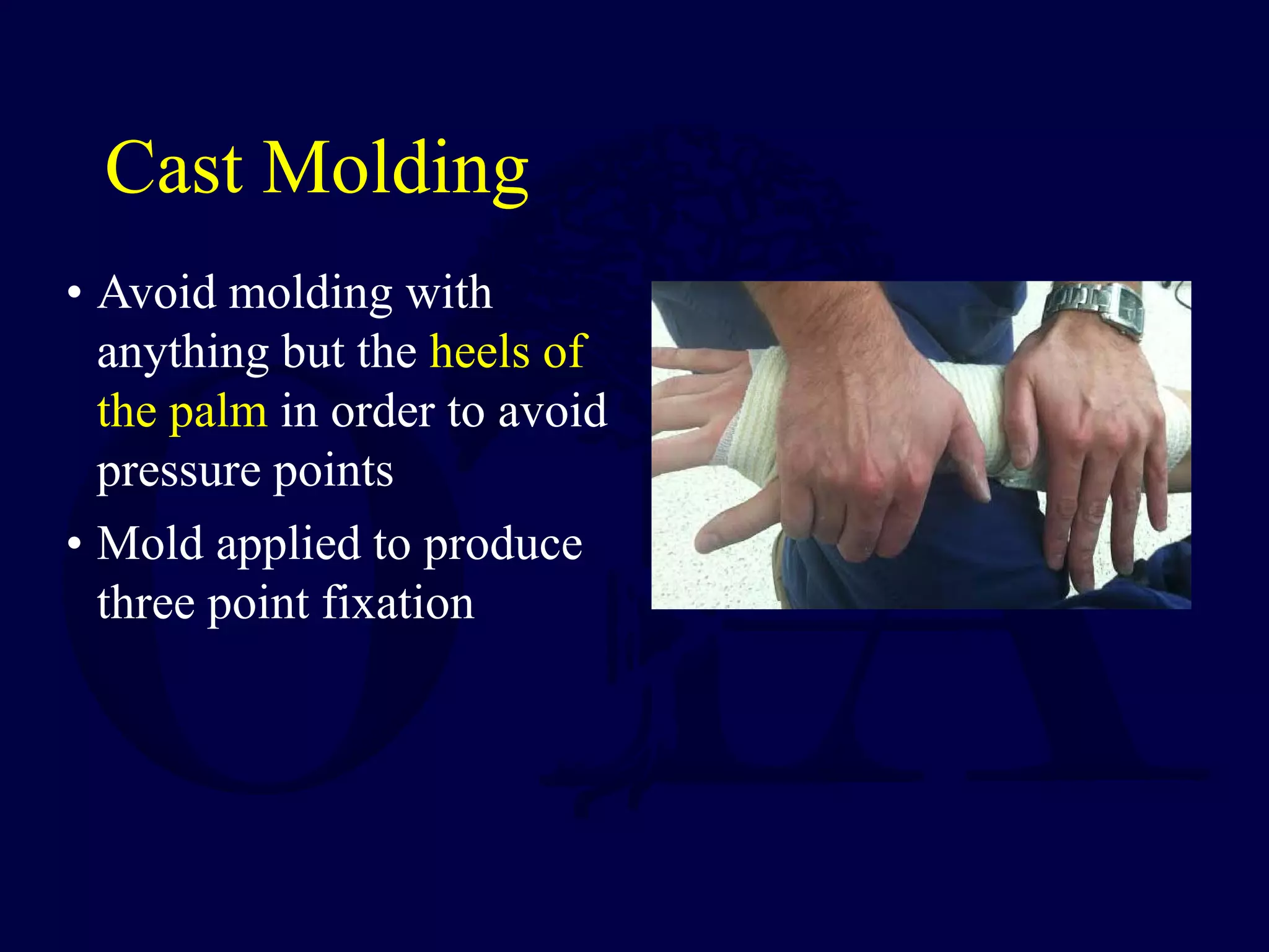 Closed_Reduction,_Traction_and_Casting_Techniques.pdf