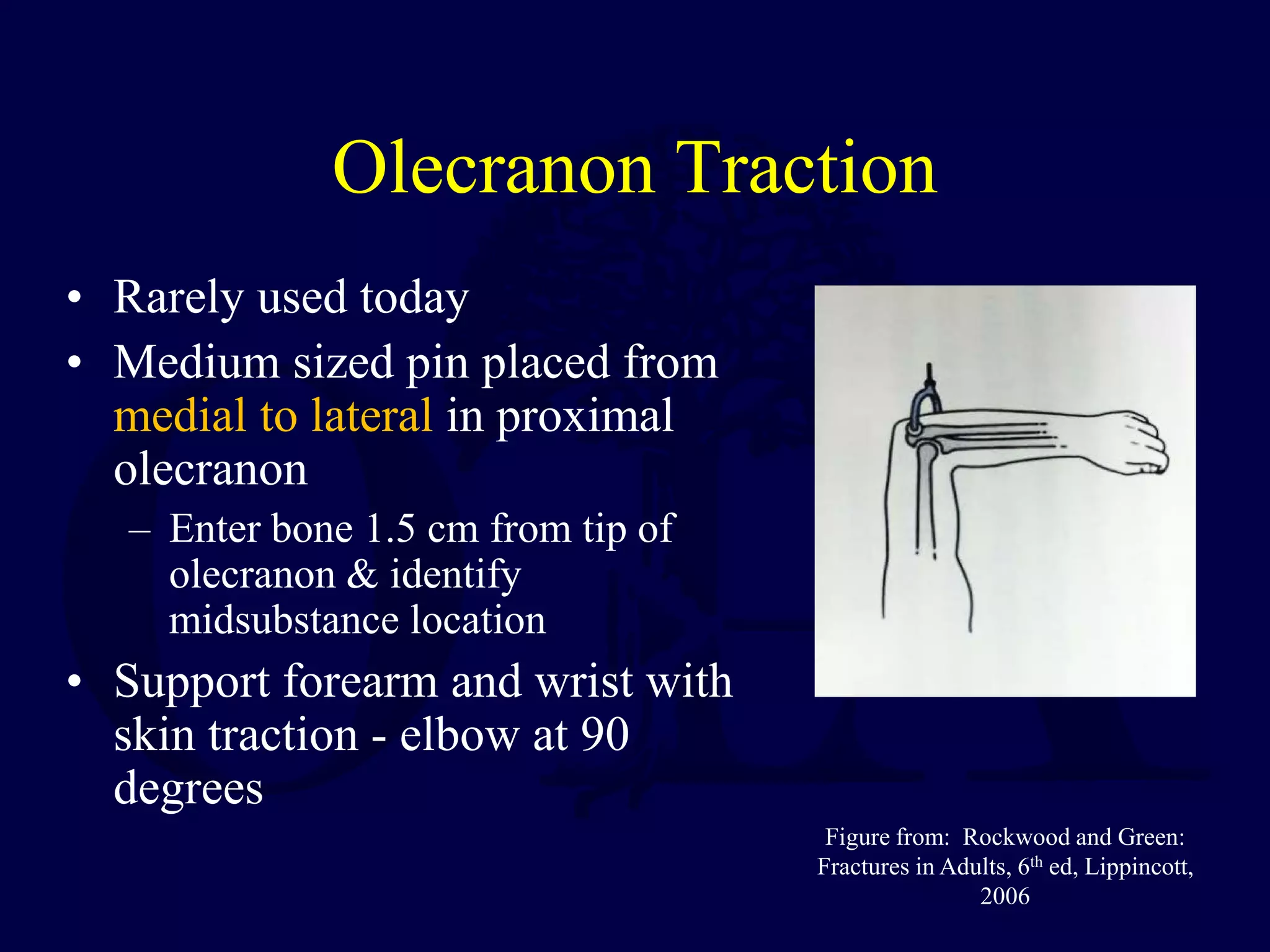 Closed_Reduction,_Traction_and_Casting_Techniques.pdf
