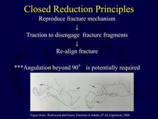 Closed_Reduction,_Traction_and_Casting_Techniques.pdf
