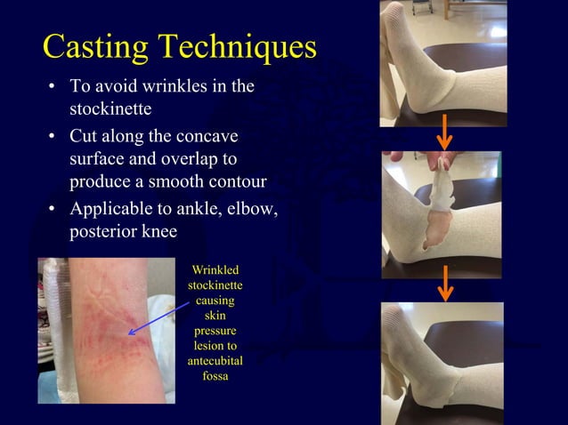Closed_Reduction,_Traction_and_Casting_Techniques.pdf