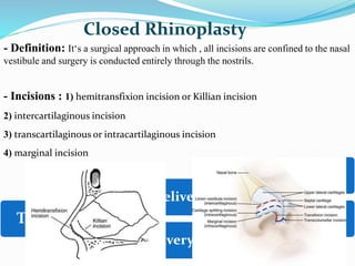 Closed rhinoplasty | PPT