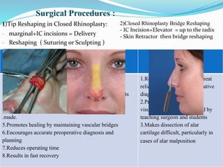 Closed rhinoplasty | PPT