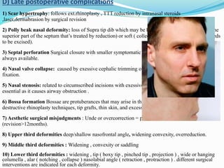 Closed rhinoplasty | PPT