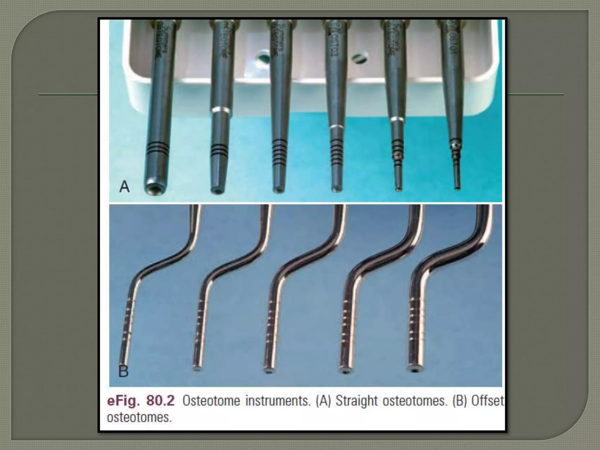 Closed Sinus Lift Surgery | PPTX